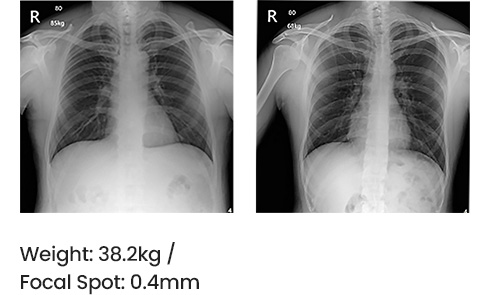 오톰 OTOM, AI software & X-ray specialized company